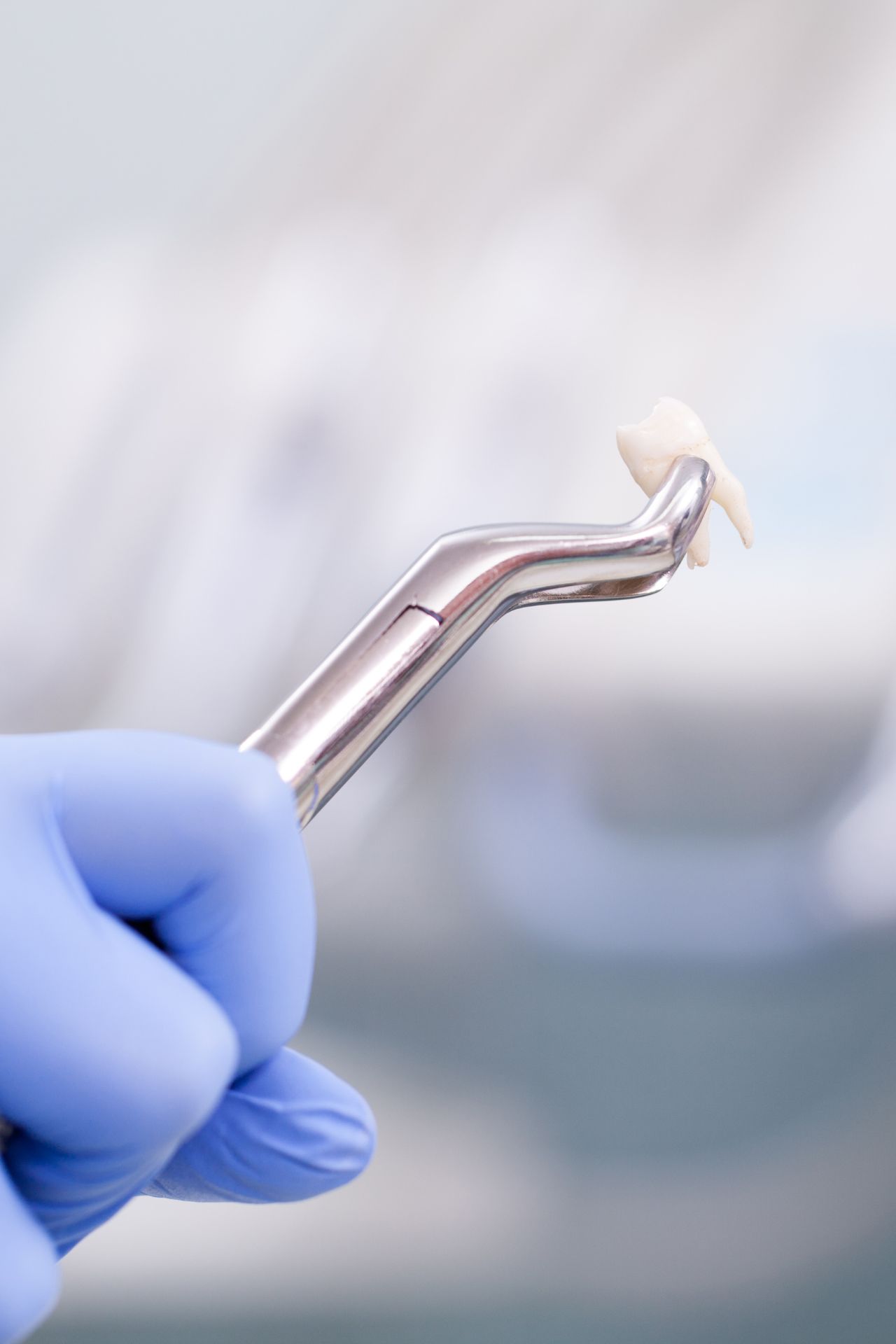 Periodontal Treatment Services | Hillsboro Dental